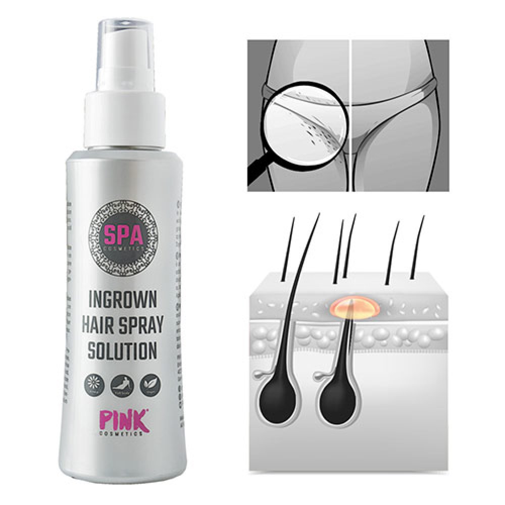 Ingrown hair Spray Solution